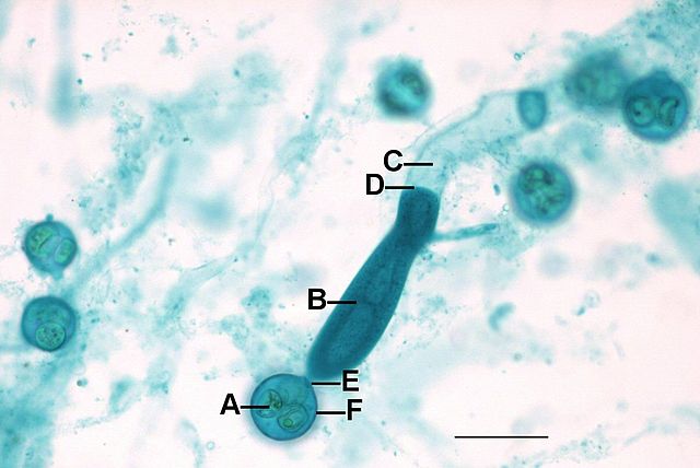 Subdivisión Mastigomycotina: oomicetes, mohos acuáticos, mildius…